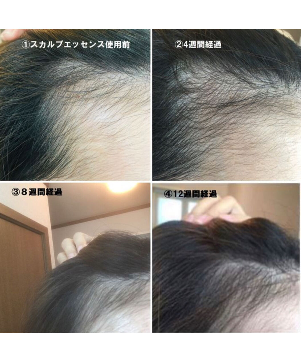 STEMLER（ステムラー）スカルプエッセンス SP 毛髪美容液 60ml | MICTH ...